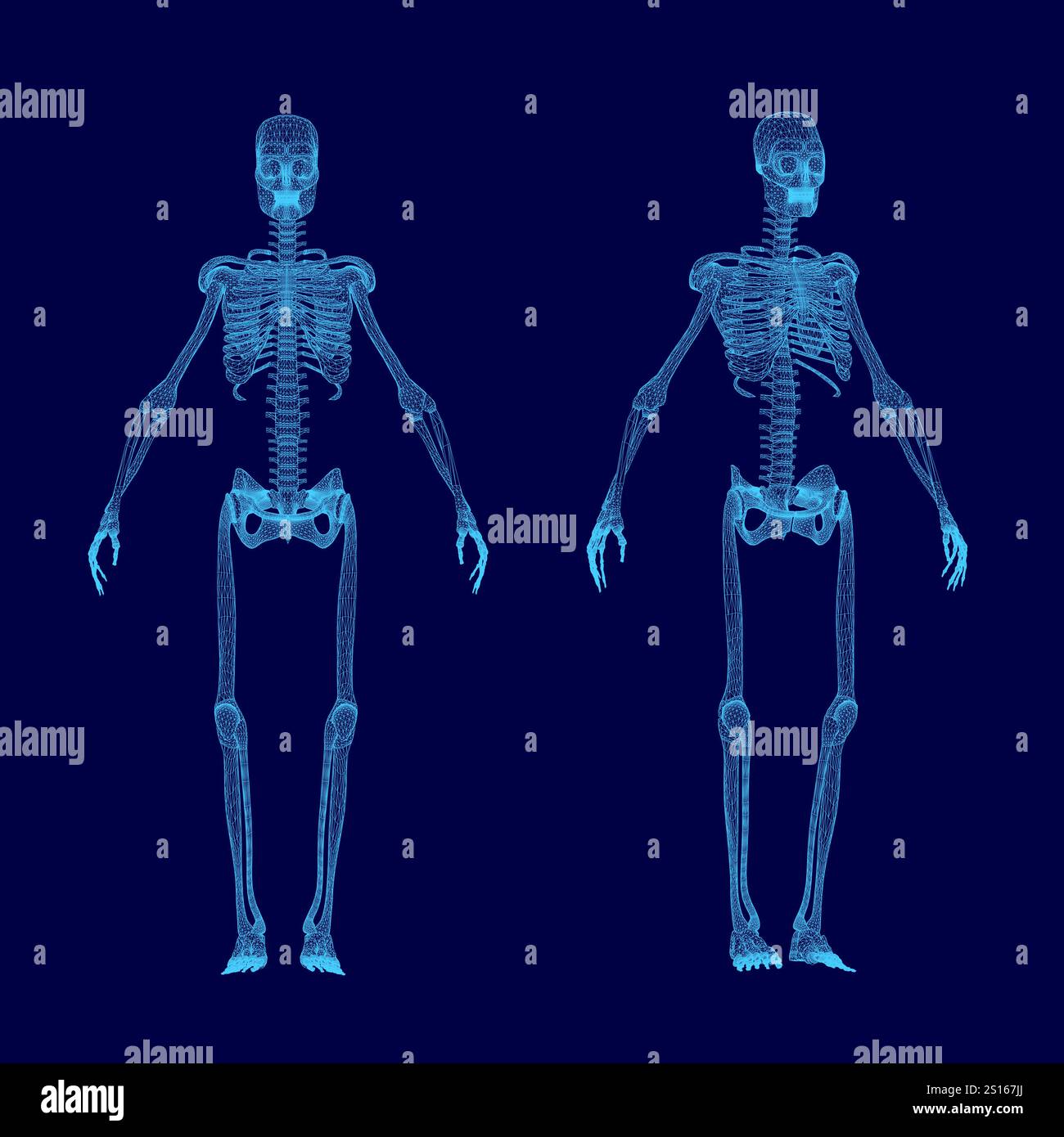 Two skeletons are shown in blue, one of which is missing a head. The ...