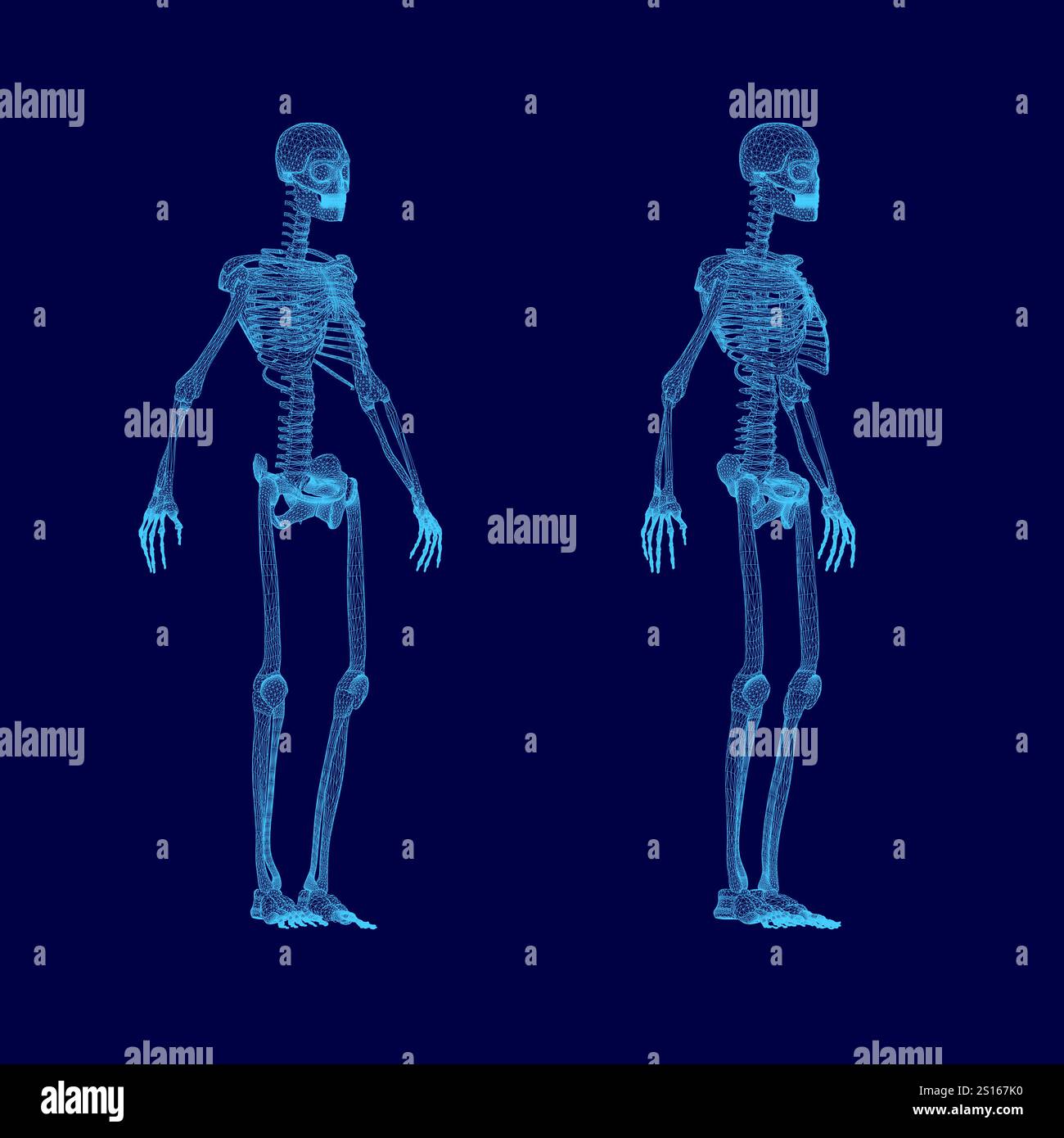 Two skeletons are shown in blue, one of which is missing a head. The ...
