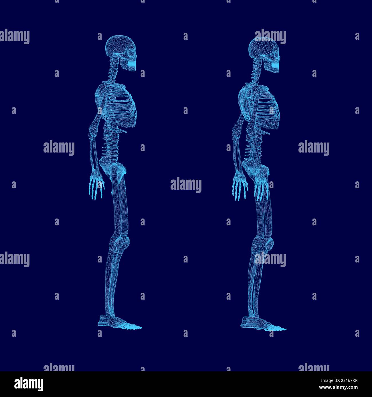 Two skeletons are shown in a blue background. The skeletons are ...
