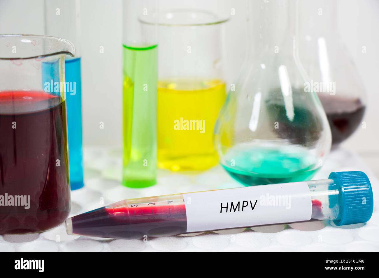 Human Metapneumovirus, HMPV virus blood and other test in laboratory ...