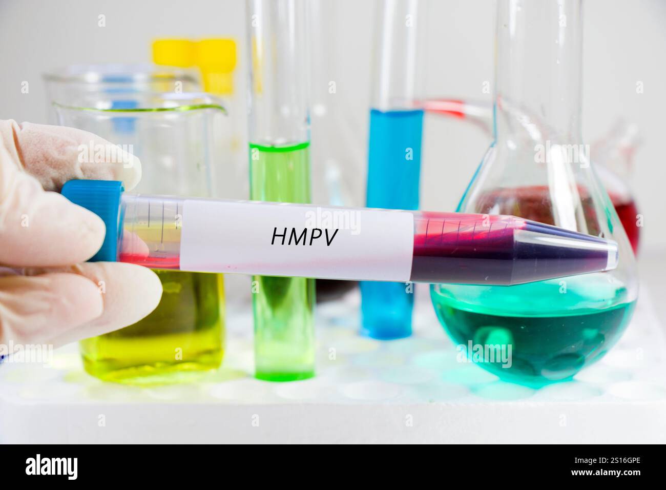 Human Metapneumovirus, HMPV virus blood and other test in laboratory ...