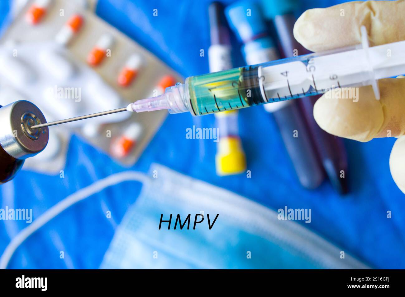 Human Metapneumovirus, HMPV virus blood and other test in laboratory ...
