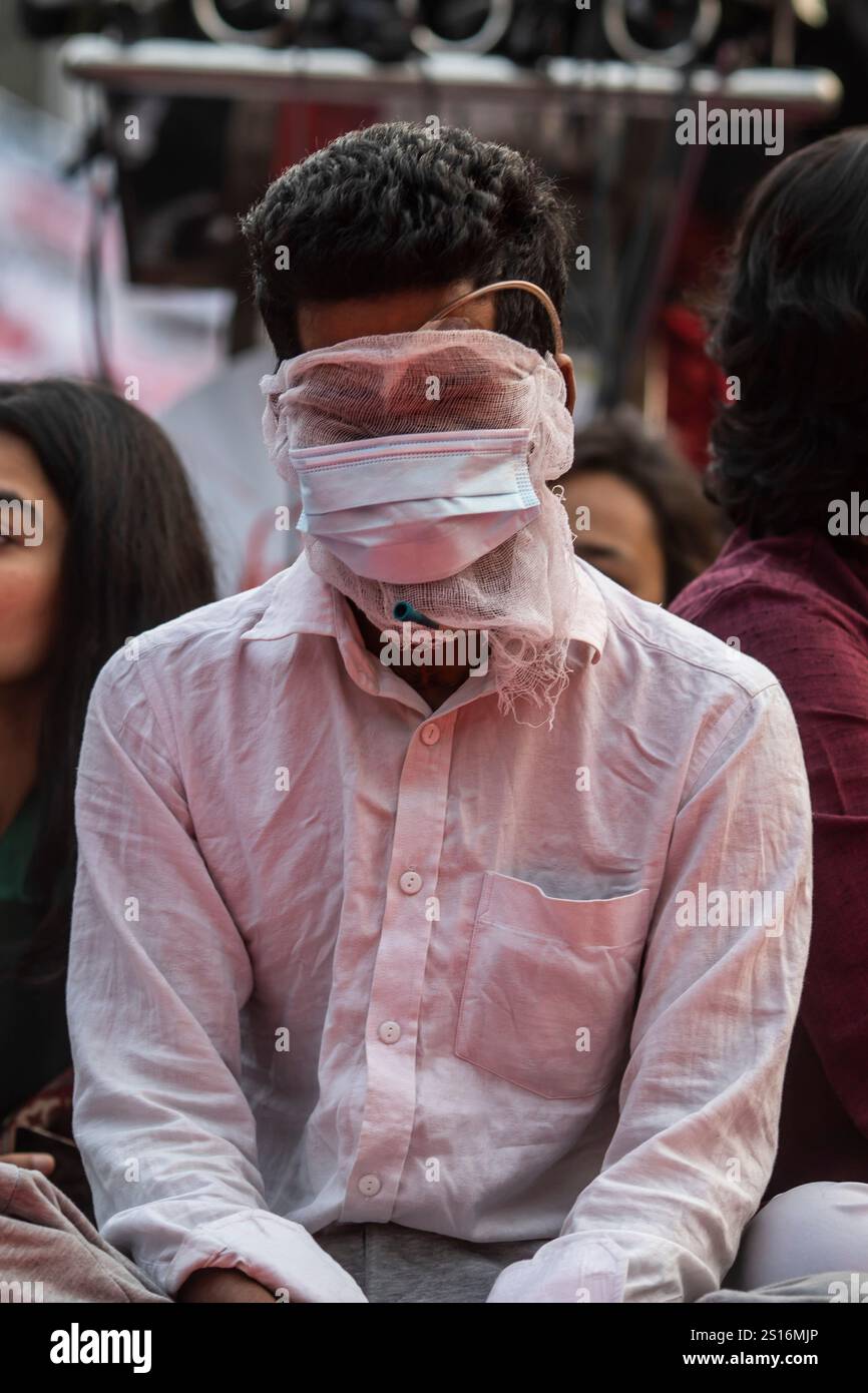 Dhaka, Bangladesh. 31st Dec, 2024. Khokon Chandra Barman, who lost his nose and parts of his ...