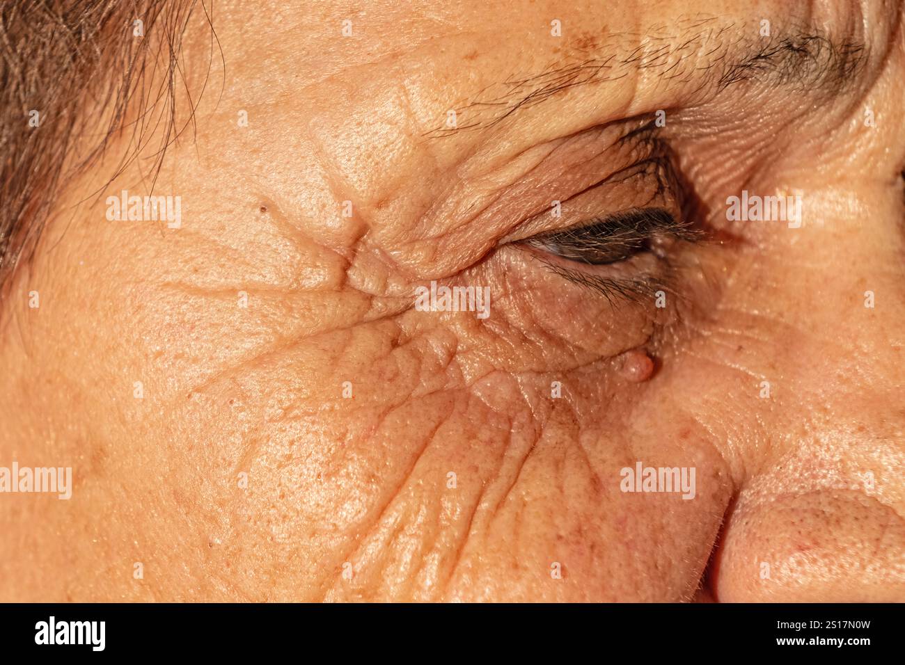 Wrinkles and moles around the eyes of an old woman Stock Photo - Alamy