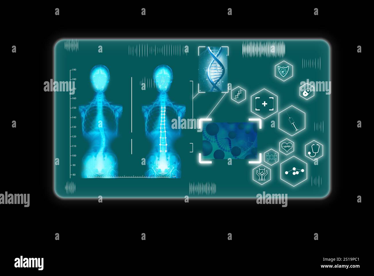 Medical technology. Virtual frame with human skeleton x-ray, DNA ...