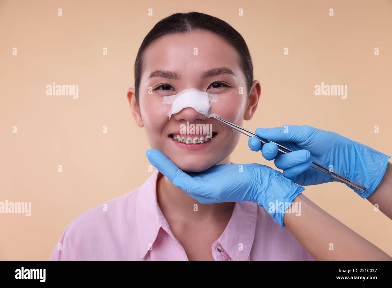 Doctor removing medical bandage from patient's nose after plastic surgery operation on beige ...