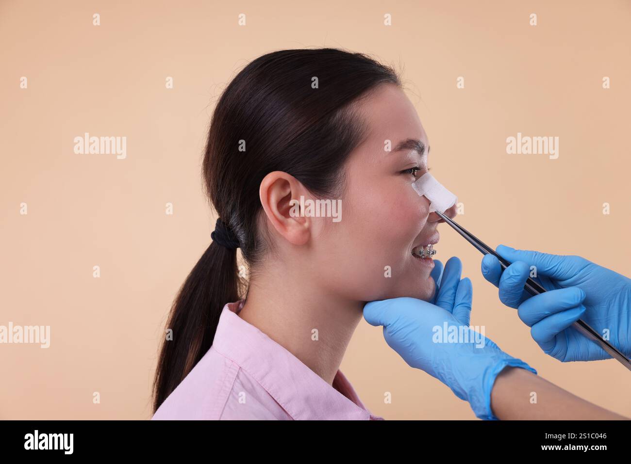 Doctor removing medical bandage from patient's nose after plastic ...