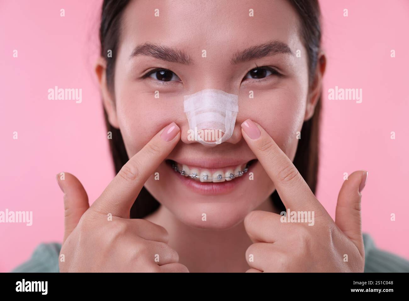 Woman with medical bandage on her nose after plastic surgery operation ...