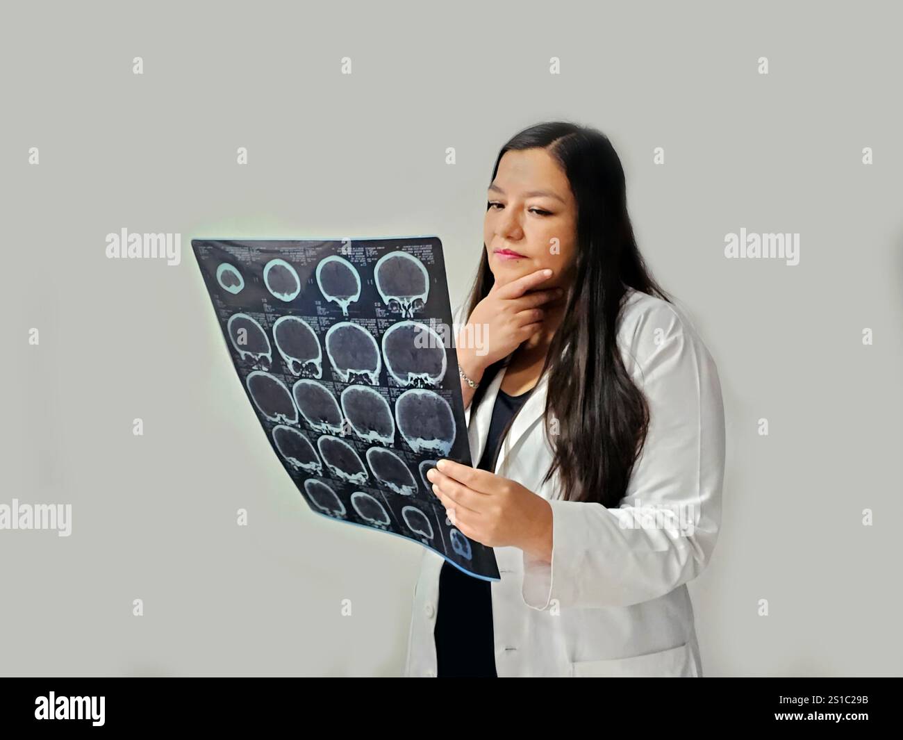 Female neurologist specialist doctor evaluates brain angiography x-ray ...