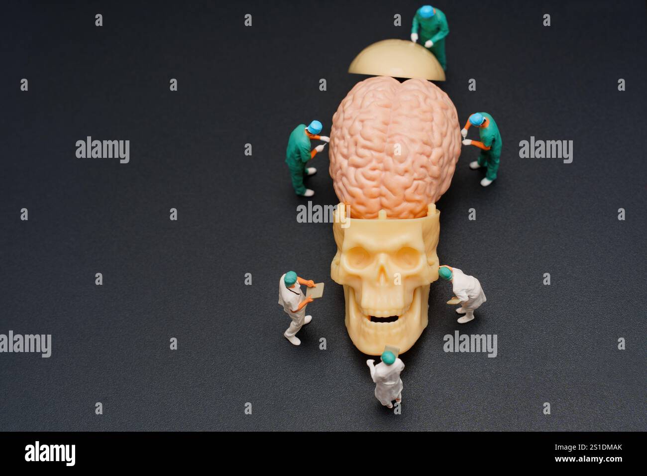 Human brain model resting inside an open skull, surrounded by miniature ...