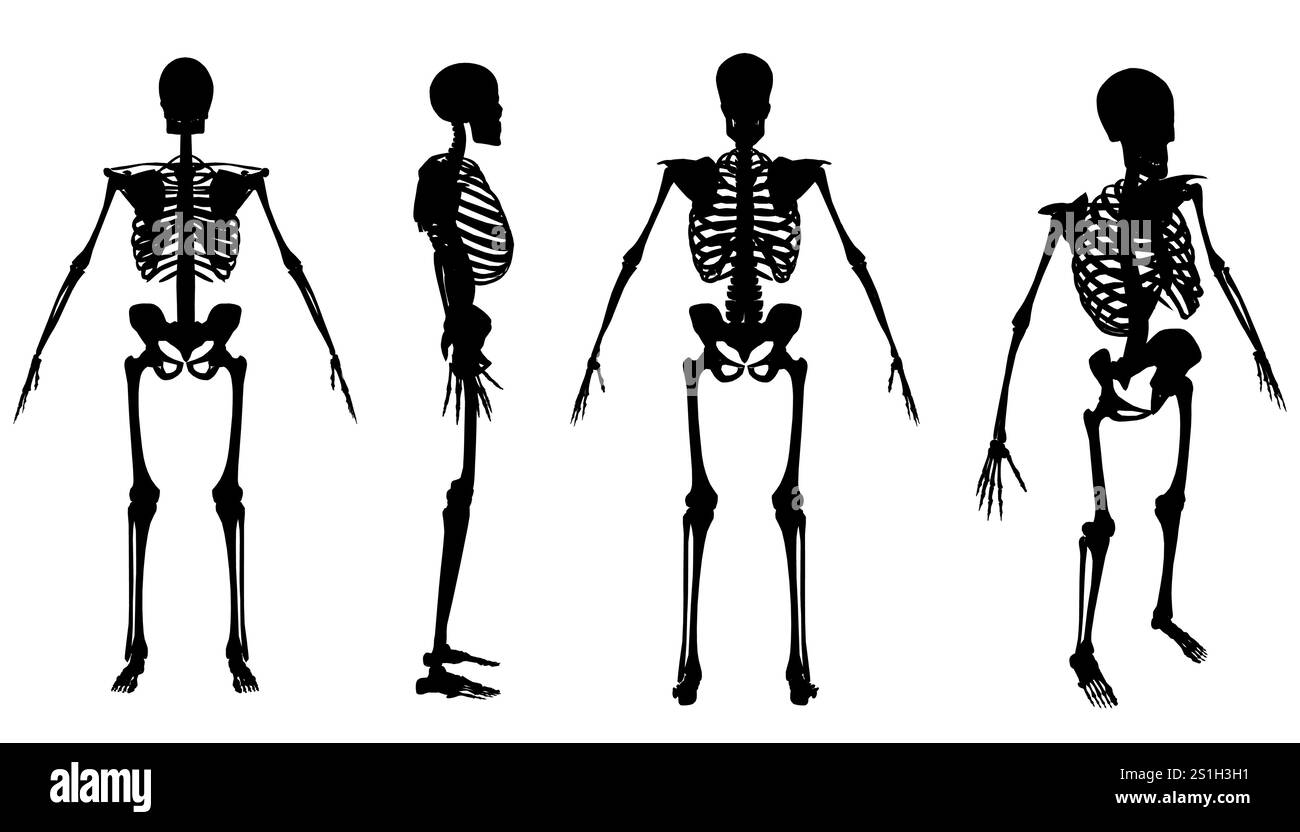 Four skeletons are shown in different positions, with one of them ...