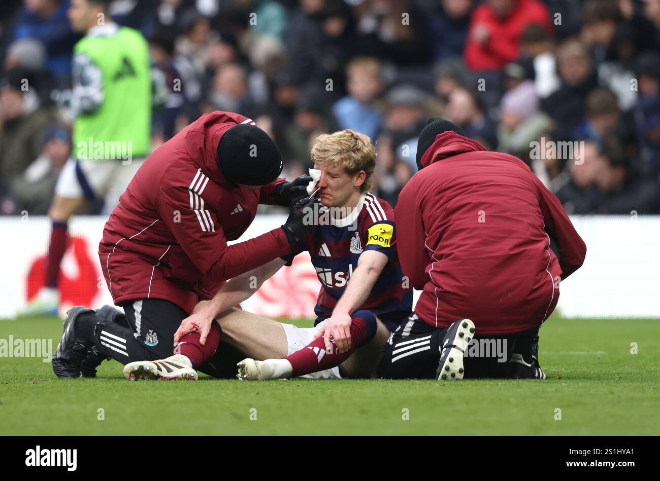 London, UK. 04th Jan, 2025. Anthony Gordon (NU) with a bloody nose at the Tottenham Hotspur v ...