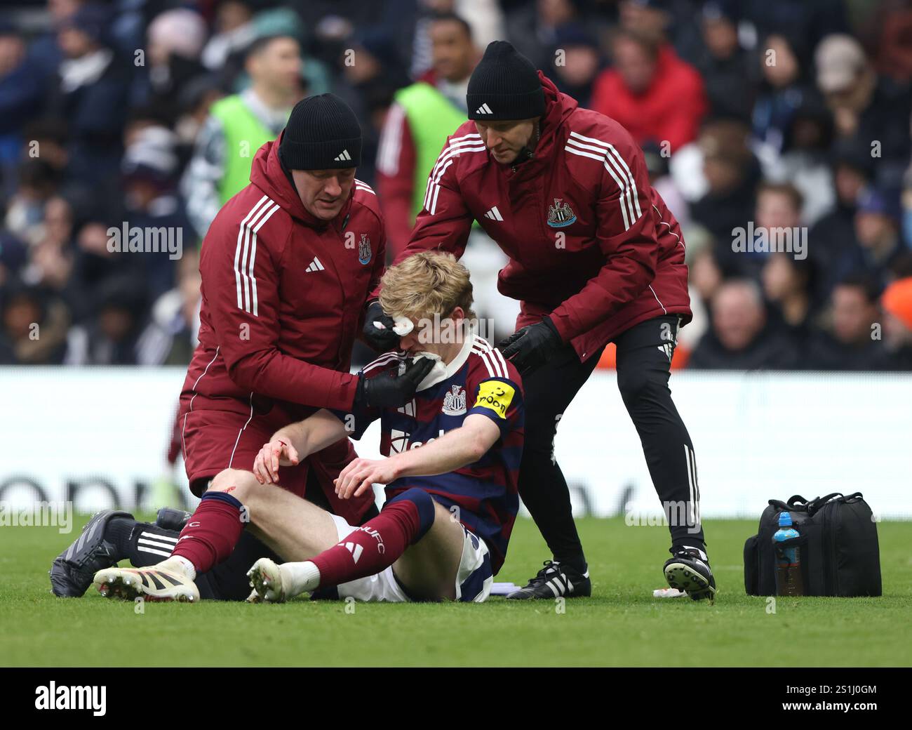 London, UK. 04th Jan, 2025. Anthony Gordon (NU) with a bloody nose at ...