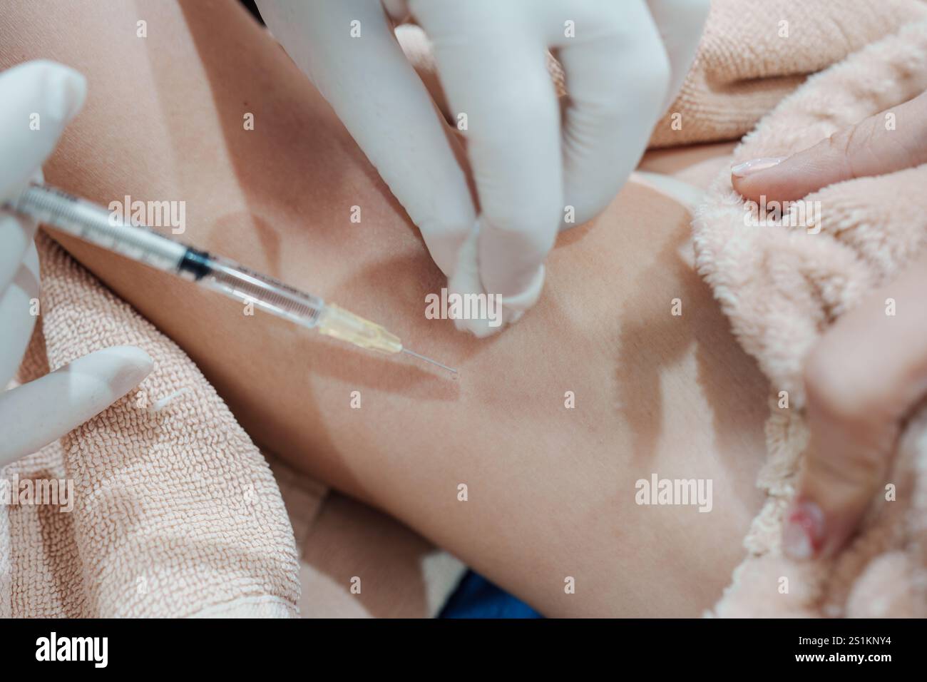 Closeup of medical specialist administering an injection with syringe ...
