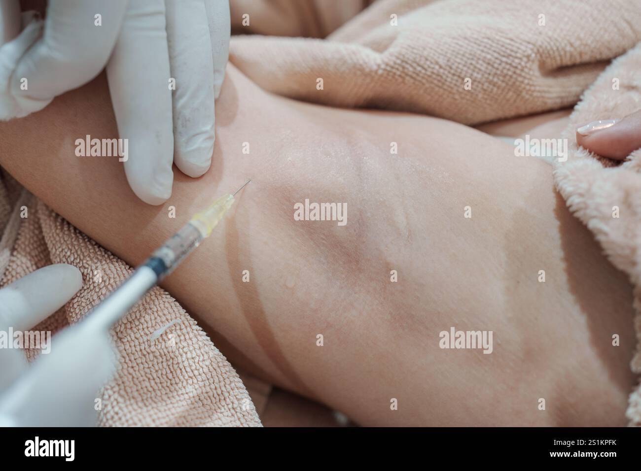 Closeup of medical specialist administering an injection with syringe ...
