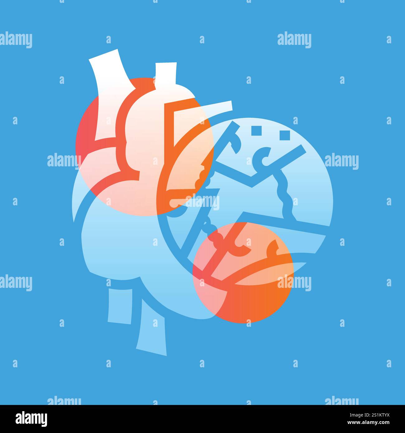 Ventricular arrhythmias Stock Vector Images - Alamy