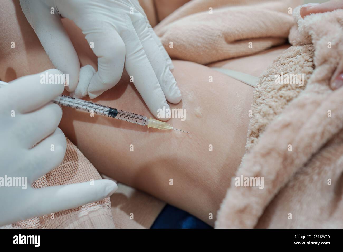 Closeup of medical specialist administering an injection with syringe ...