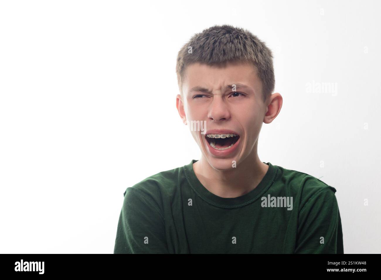 Close-up shot of a teenage boy with braces, his mouth open in a yell or ...