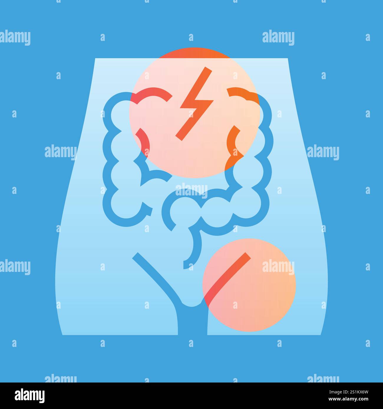 Stomach disorder glassmorphism illustration. Transparency blur elements ...