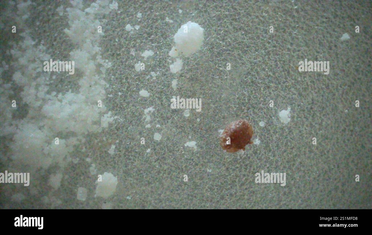 Varroa Mite (Varroa destructor Stock Photo - Alamy