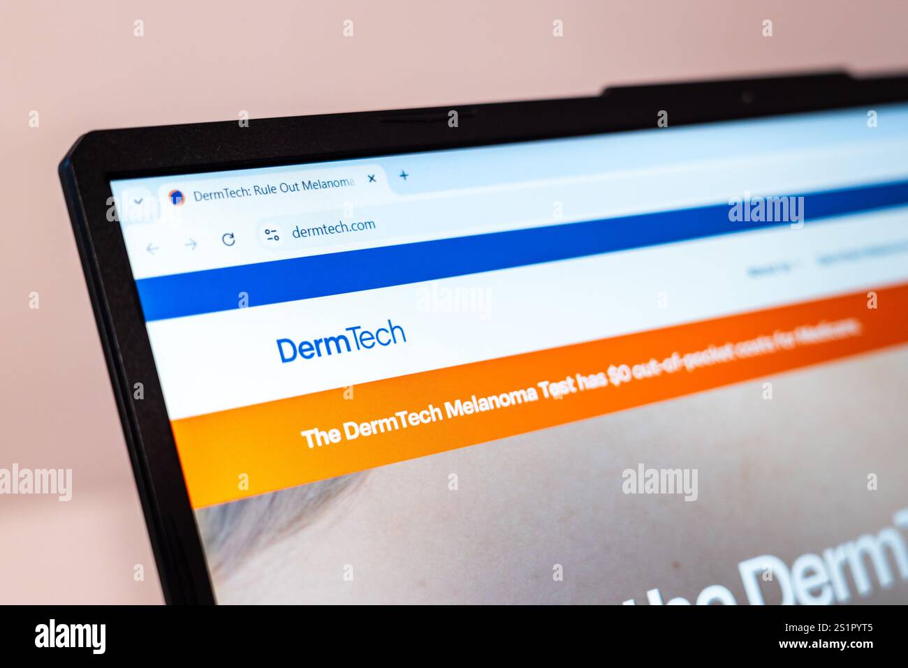 New York, USA - January 01, 2025: DermTech website displayed on a ...