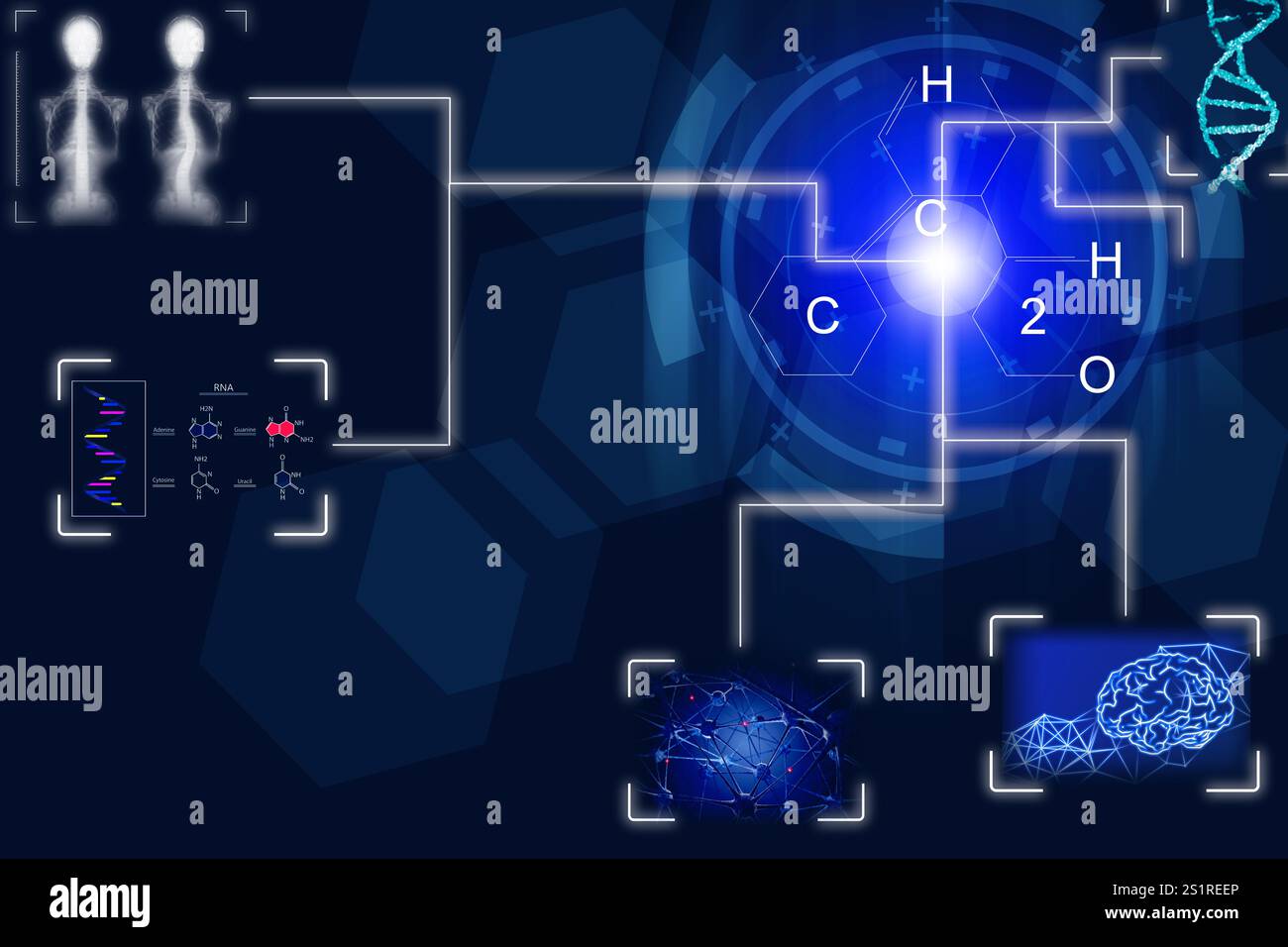 Medical technology. Scheme with human skeleton x-ray, data, DNA, brain ...