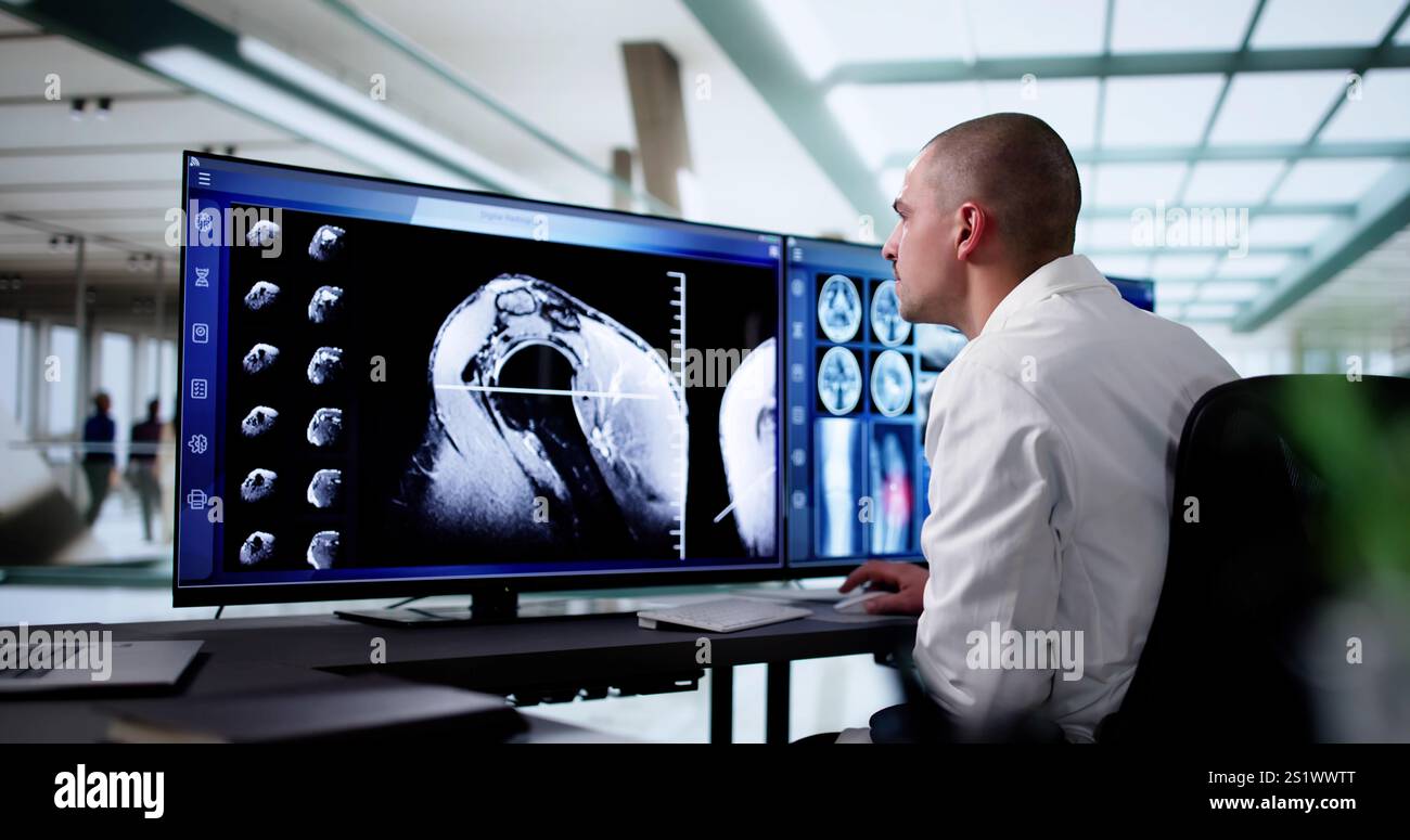 Doctor Screening Spine X Ray On Computer Stock Photo - Alamy