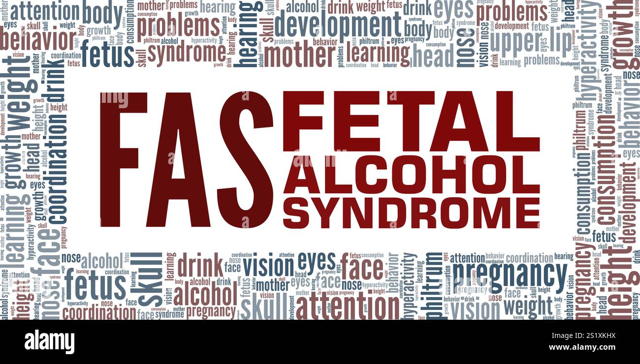 FAS - Fetal Alcohol Syndrome word cloud conceptual design isolated on ...