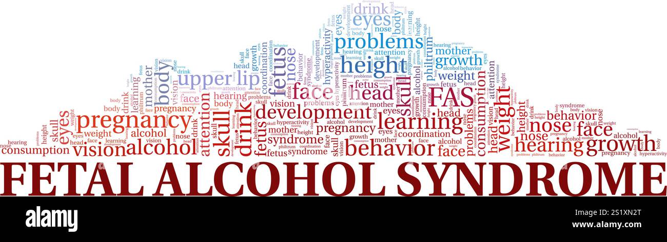 FAS - Fetal Alcohol Syndrome word cloud conceptual design isolated on ...