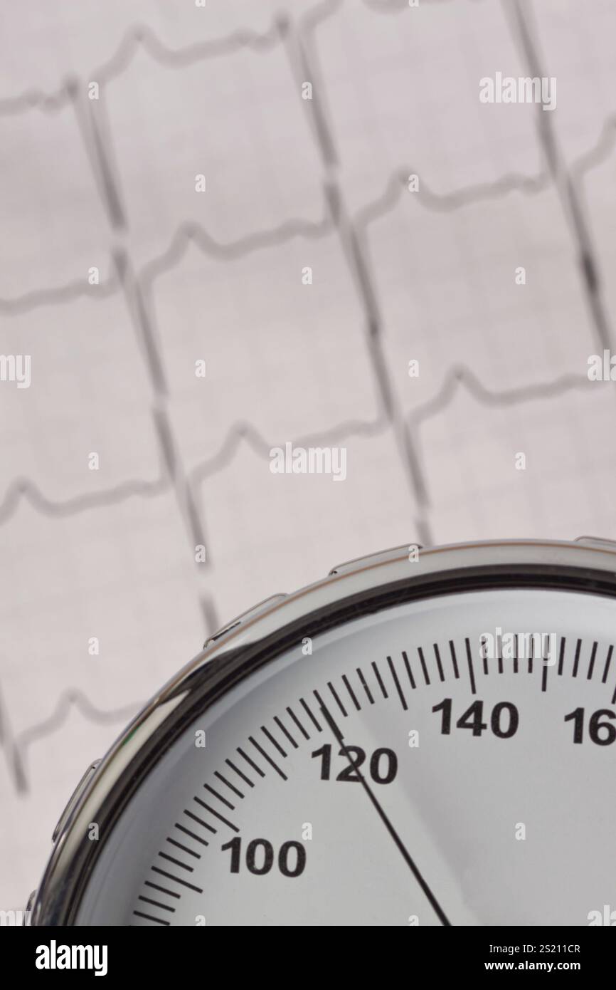 Blood pressure measurement and ECG curve. Sickness caused by high blood ...