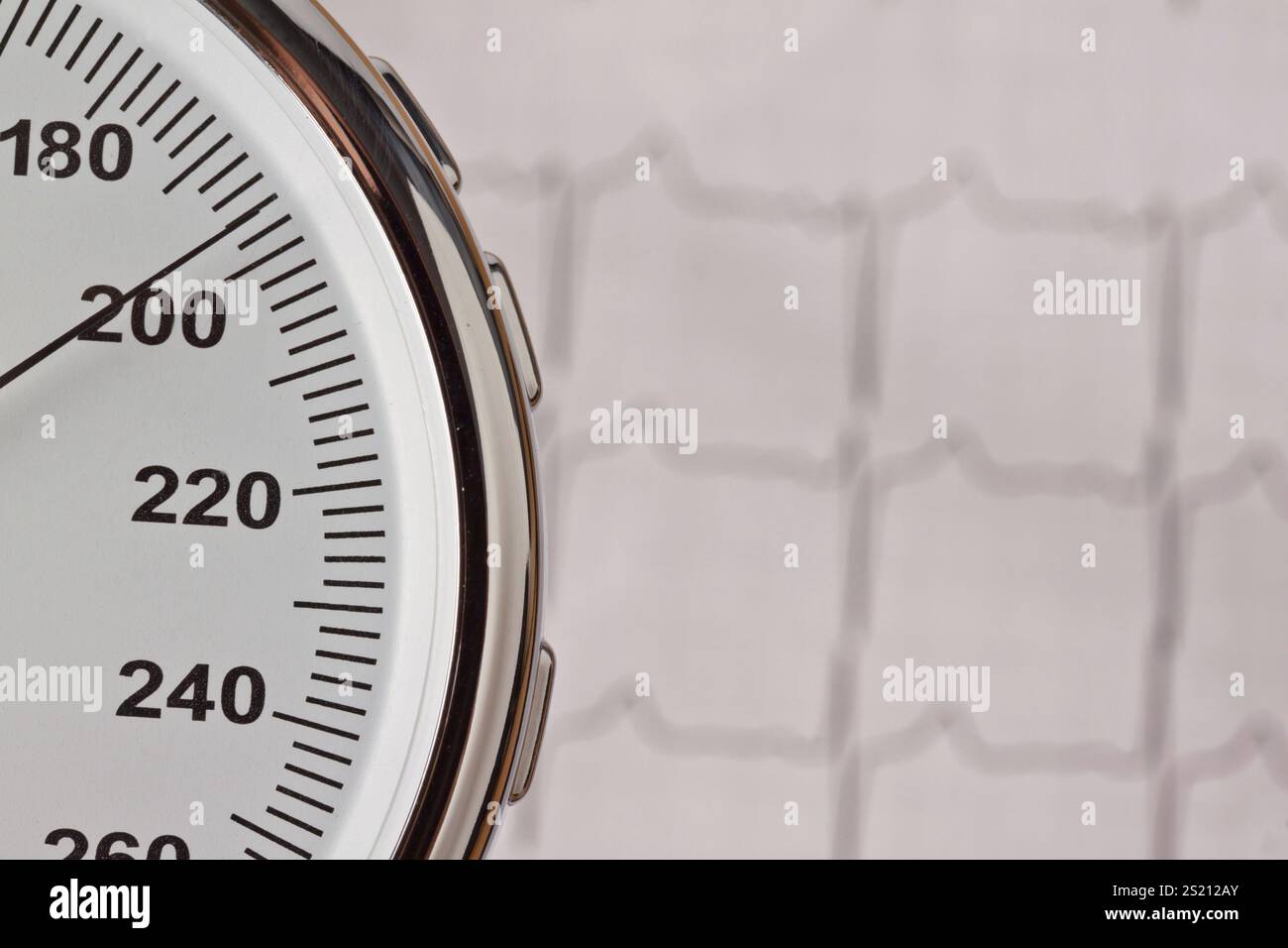 Blood pressure measurement and ECG curve. Sick due to high blood ...