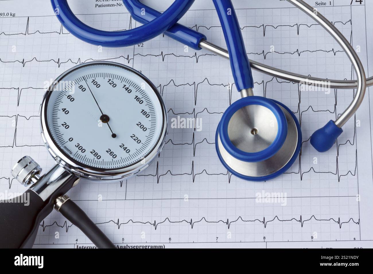 Blood pressure measurement and ECG curve. Sickness caused by high blood ...