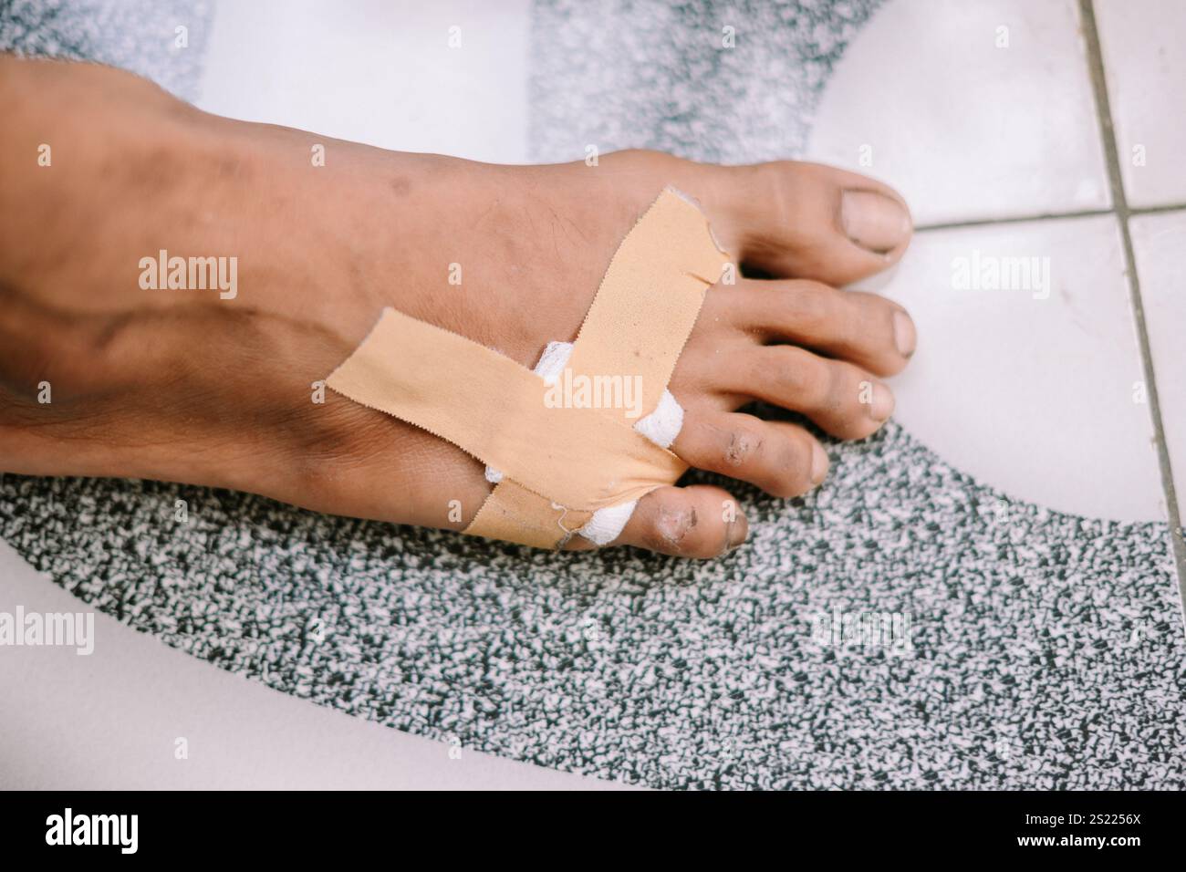 A close-up of a bandaged wound on the right foot looks neat Stock Photo ...
