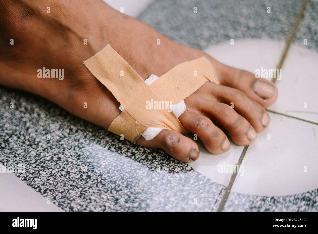 A close-up of a bandaged wound on the right foot looks neat Stock Photo ...