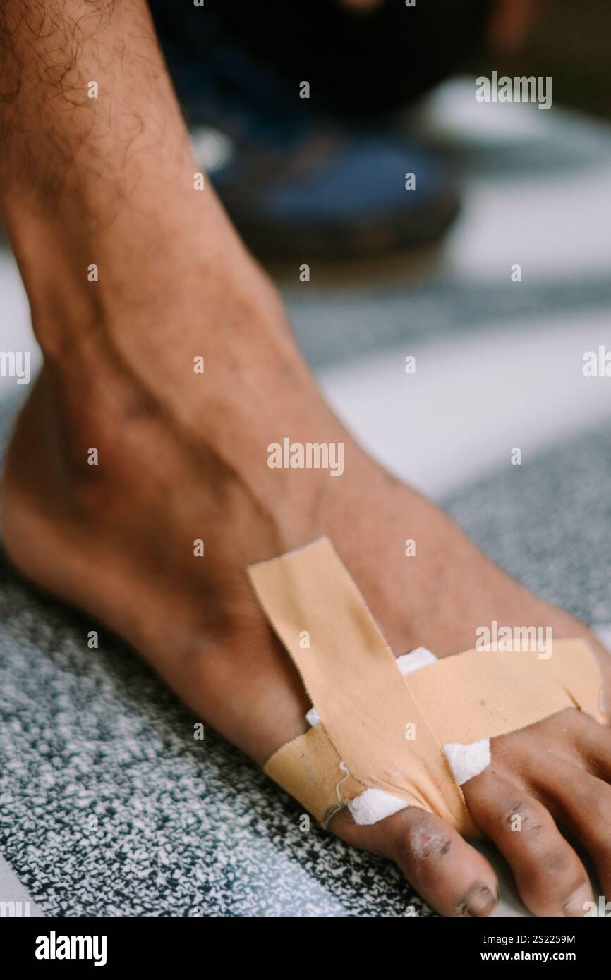 A close-up of a bandaged wound on the right foot looks neat Stock Photo ...
