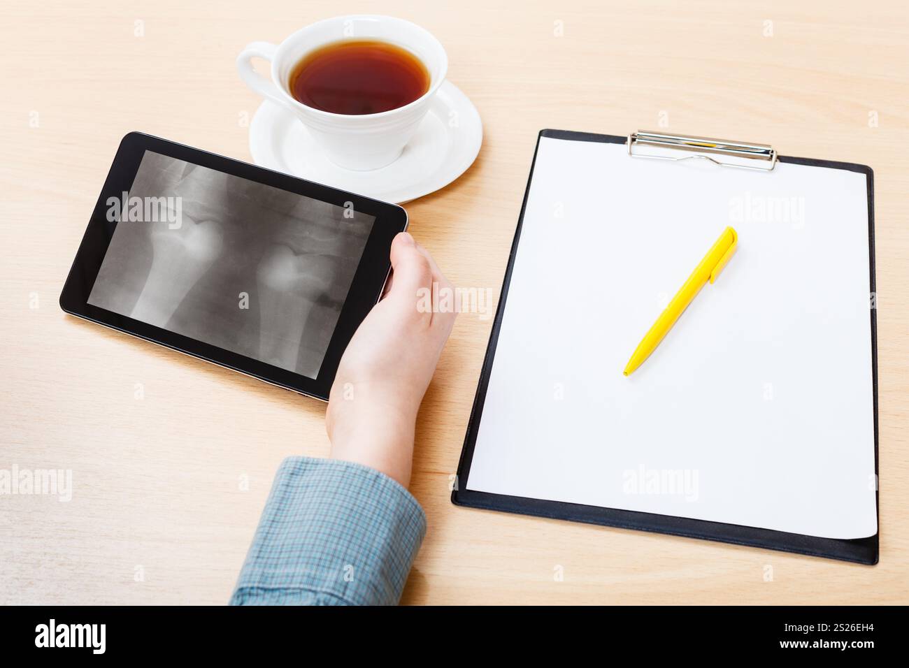 medic analyzes X-ray picture of two human knee-joints on screen on ...