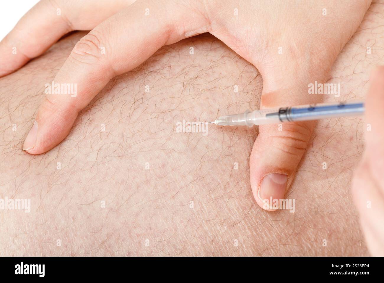 patient makes diabetic insulin injections in the thigh Stock Photo - Alamy
