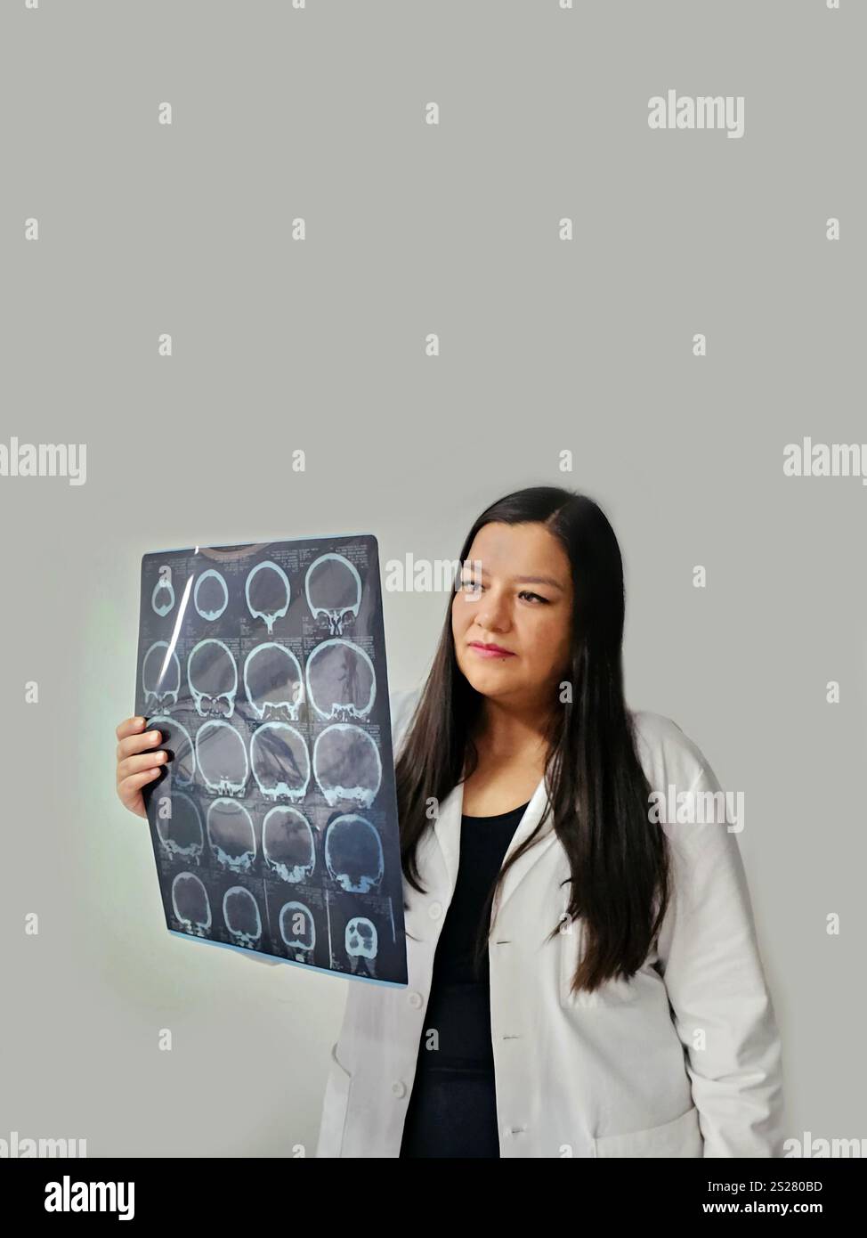 Female neurologist specialist doctor evaluates brain angiography x-ray ...