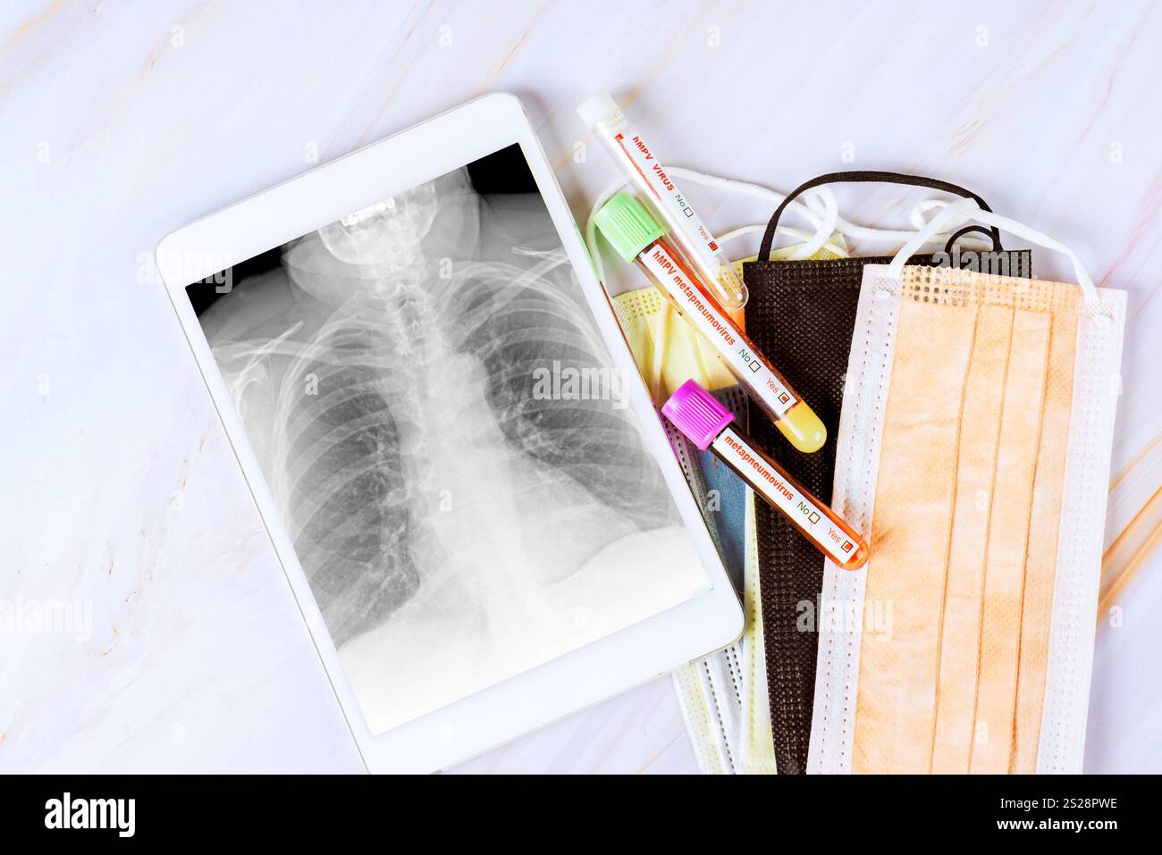 Diagnostic equipment includes chest X-ray alongside protective masks ...