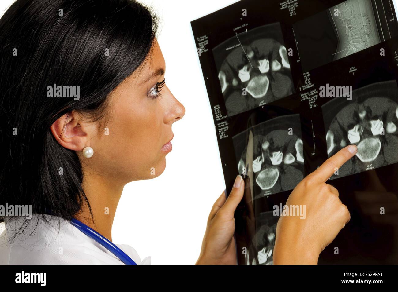 A doctor holds the X-ray image of an intervertebral disc infiltration ...