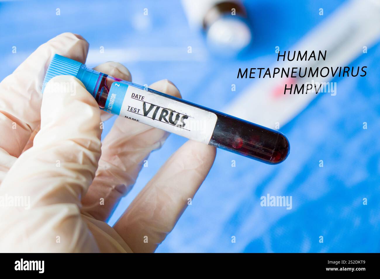 Human Metapneumovirus, HMPV virus test in lab Stock Photo - Alamy