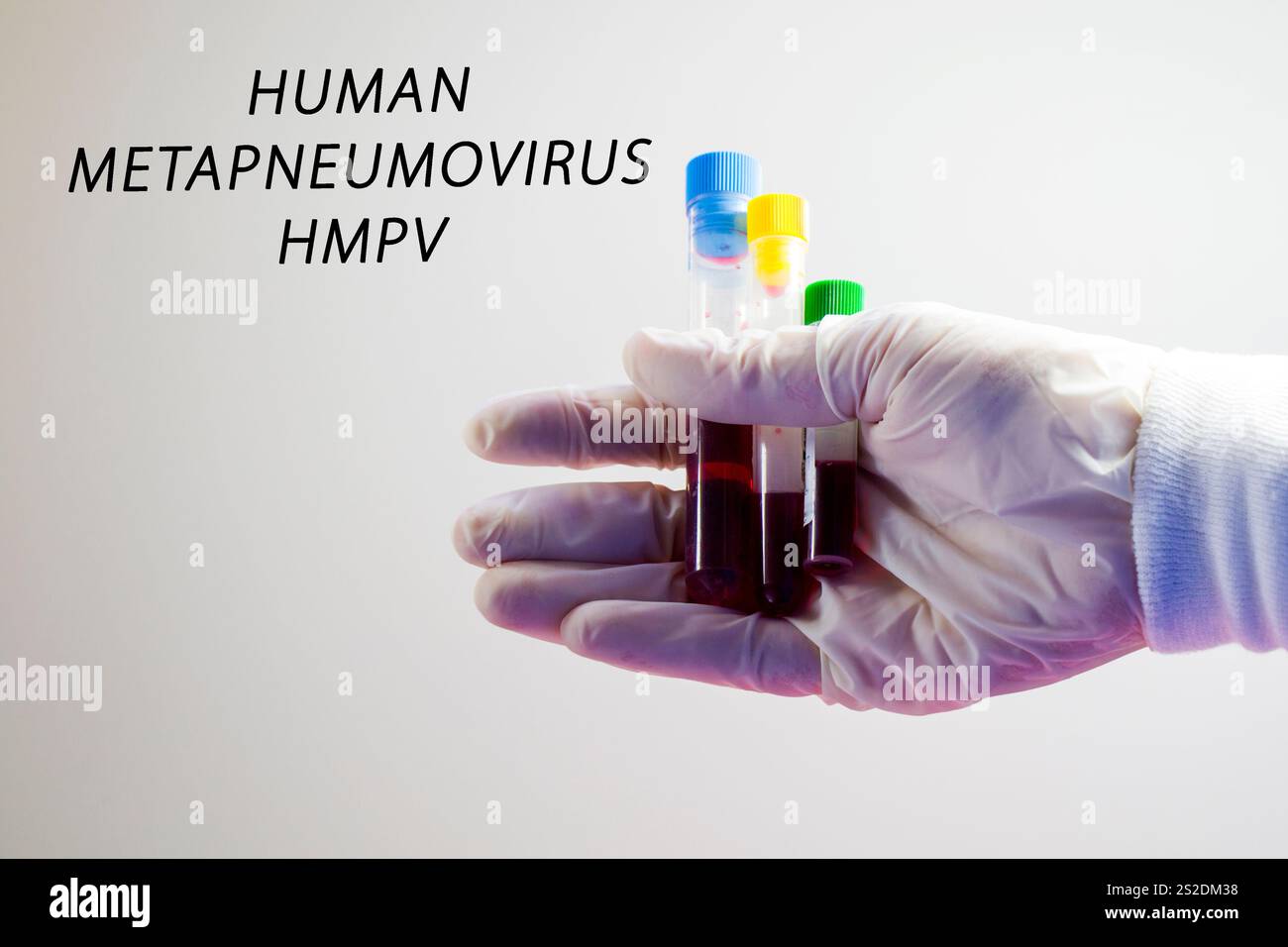 Human Metapneumovirus, HMPV virus test in lab Stock Photo - Alamy