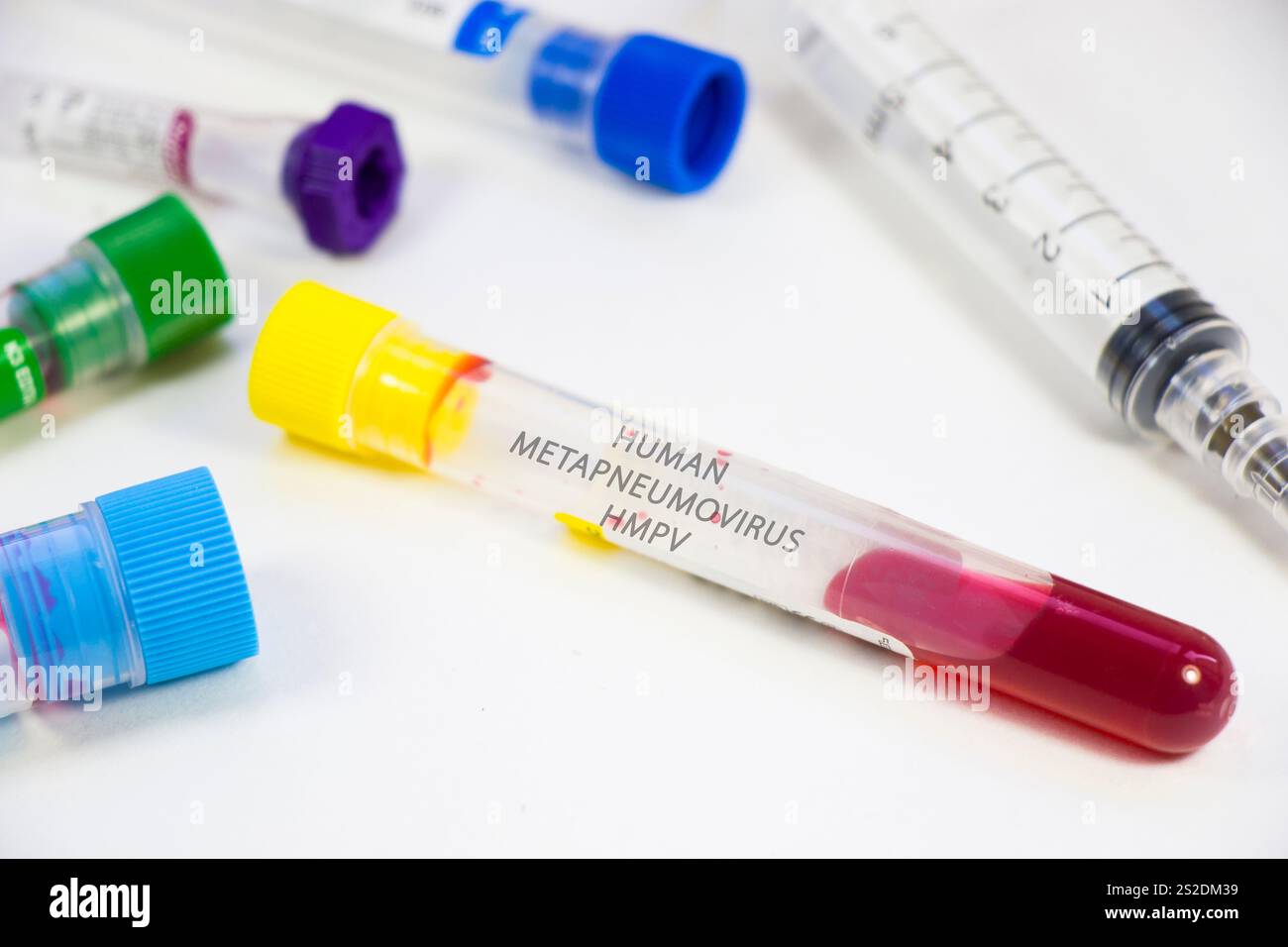 Human Metapneumovirus, HMPV virus test in lab Stock Photo - Alamy