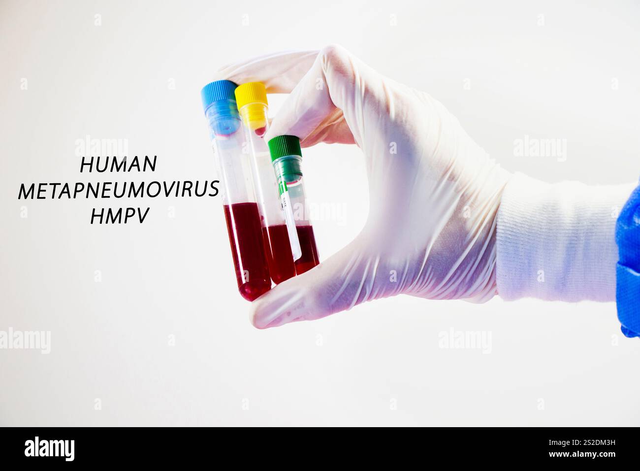 Human Metapneumovirus, HMPV virus test in lab Stock Photo - Alamy