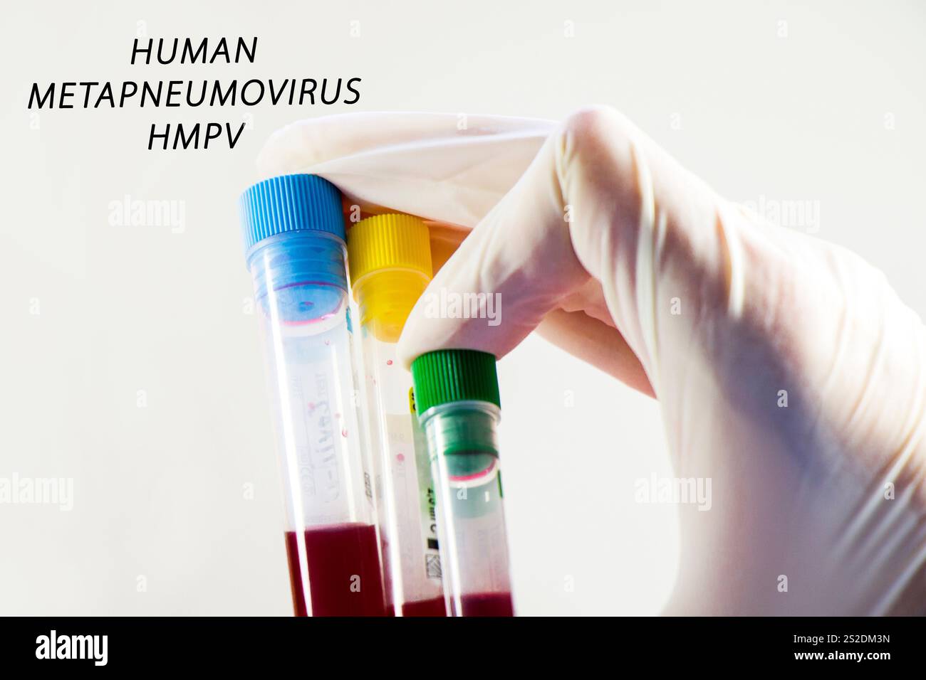 Human Metapneumovirus, HMPV virus test in lab Stock Photo - Alamy