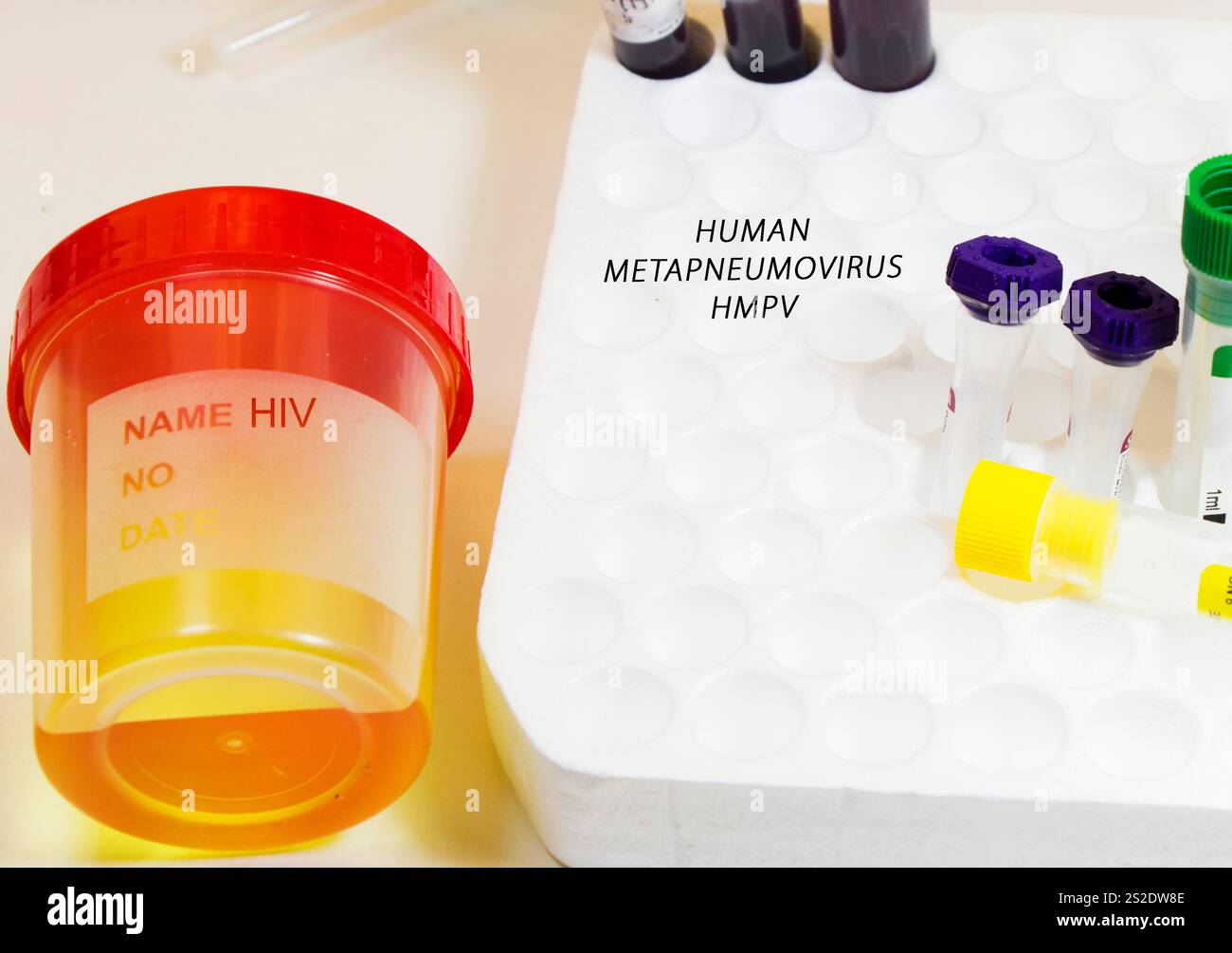 Human metapneumovirus vaccine hi-res stock photography and images - Alamy