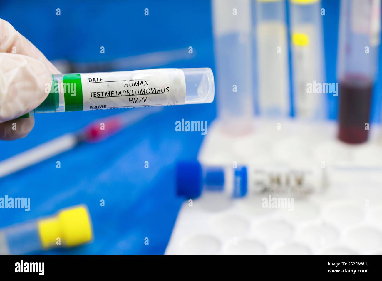 Human Metapneumovirus, HMPV virus test in lab Stock Photo - Alamy
