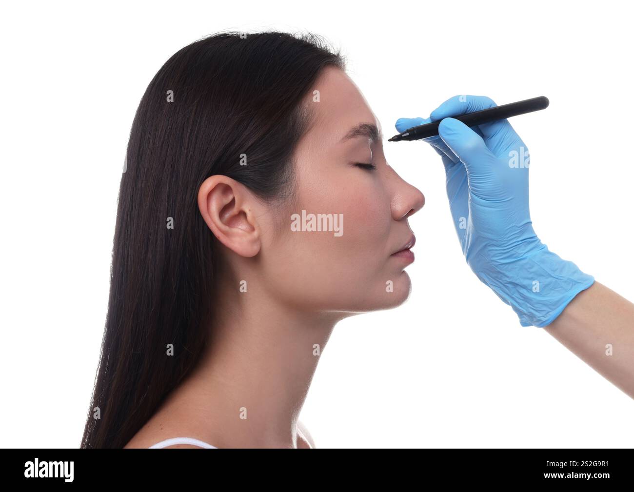Doctor drawing marks on patient's nose for plastic surgery operation ...