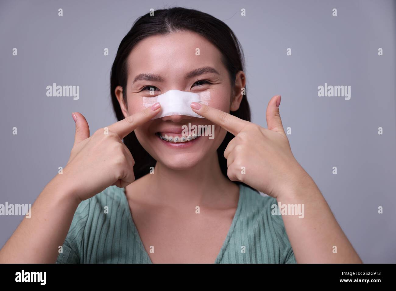 Woman with medical bandage on her nose after plastic surgery operation ...