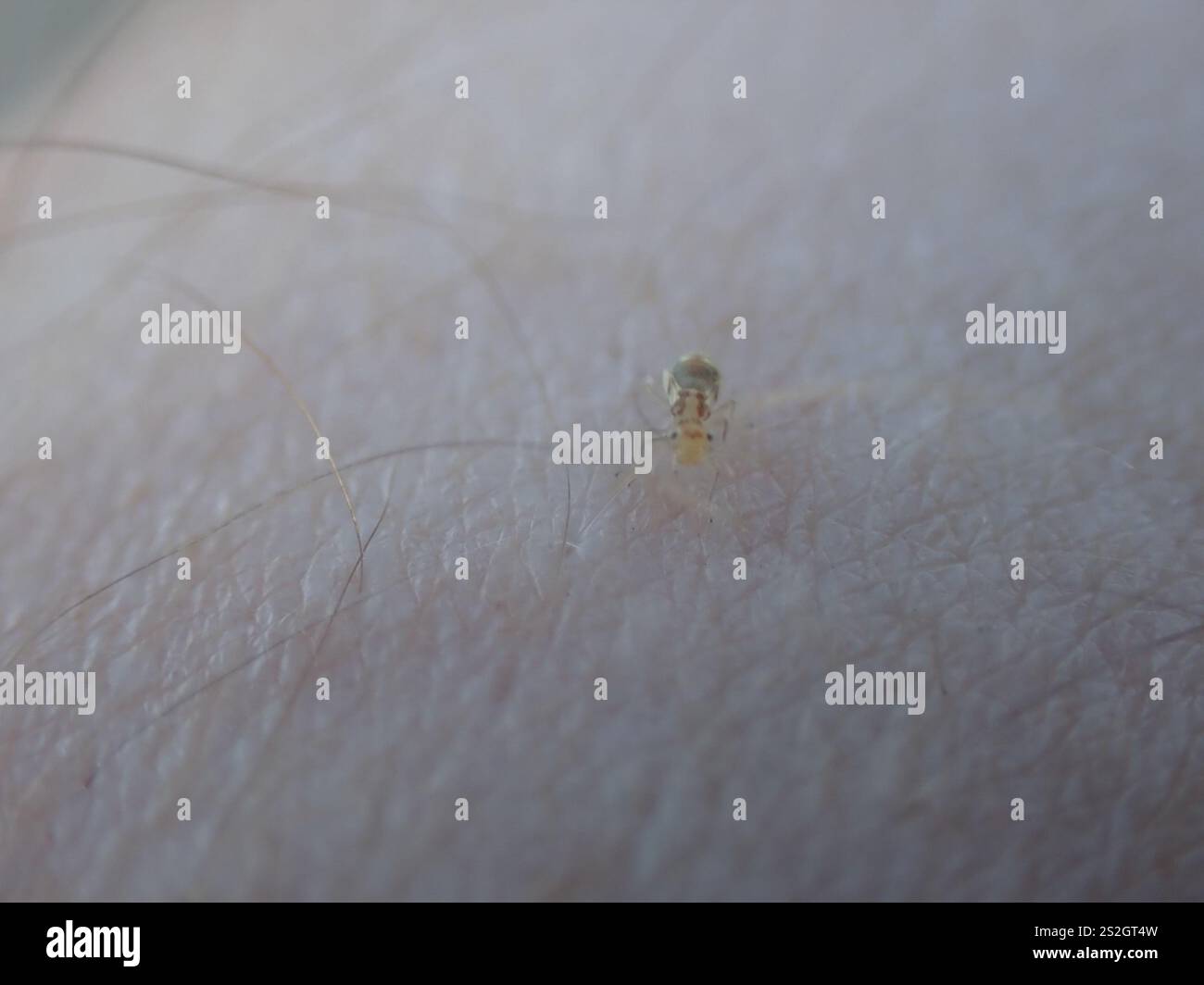 Barklice, Booklice, and Parasitic Lice (Psocodea Stock Photo - Alamy